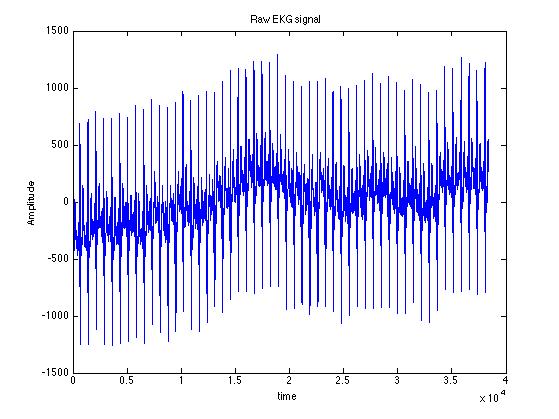 Introduction, Ecg signal analysis for myocardial infarction, By OpenStax | Jobilize